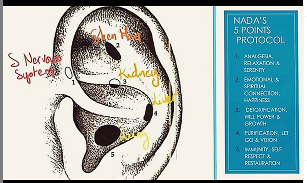 Acupuncture - Effective for Treating Addiction | Spark Of Life